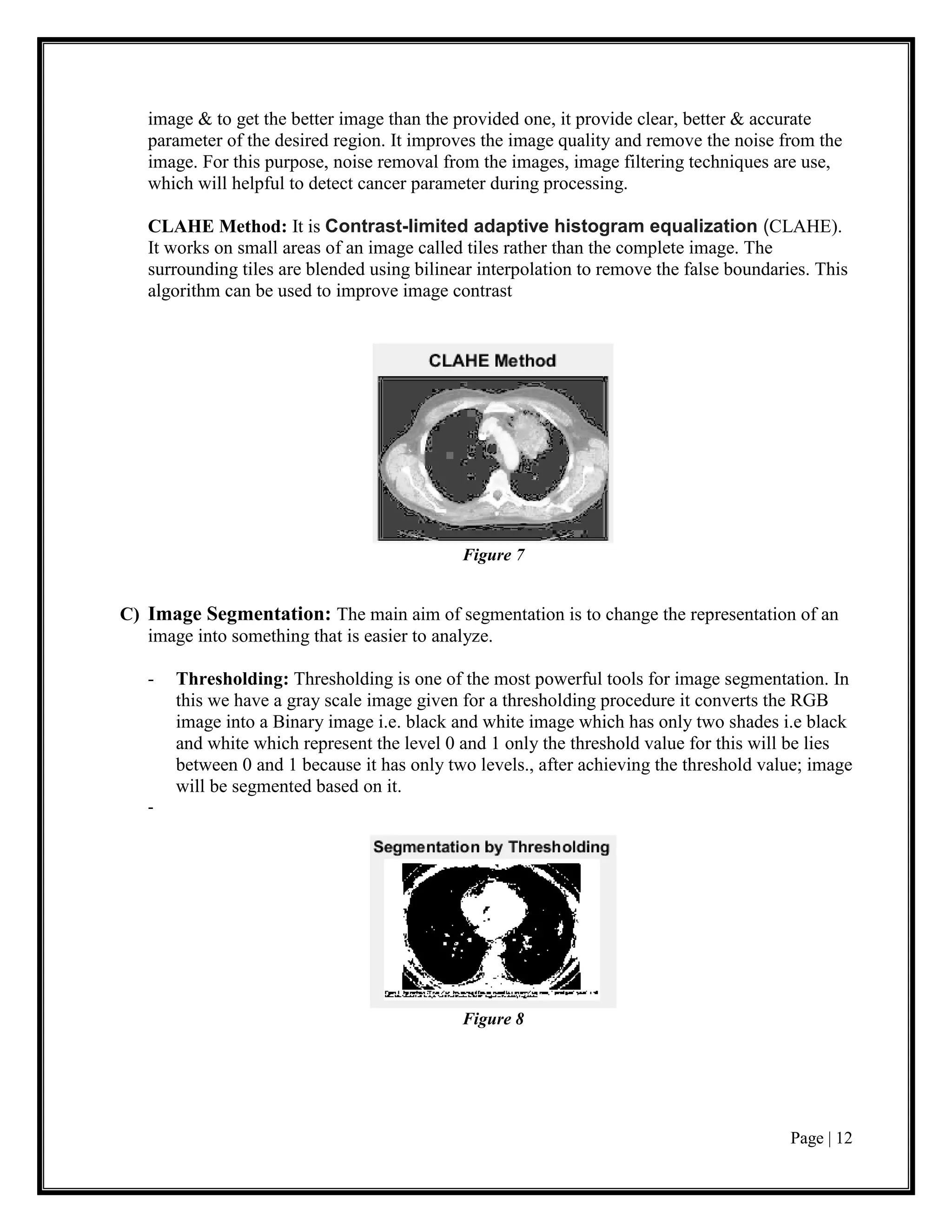 Lung Tumour Detection using Image Processing | PDF