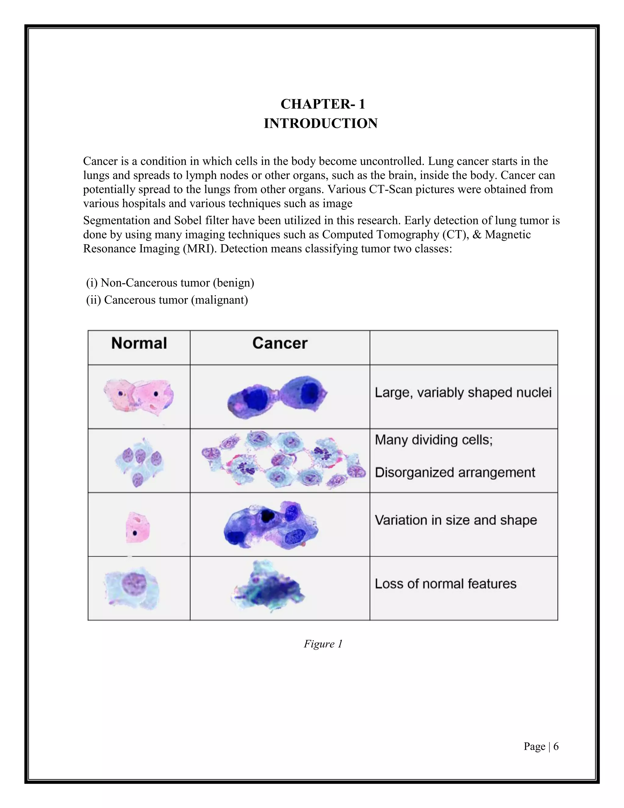 Lung Tumour Detection using Image Processing | PDF