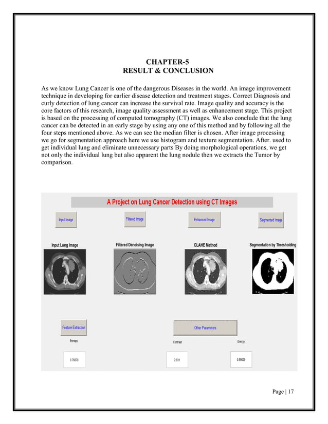 Lung Tumour Detection using Image Processing | PDF