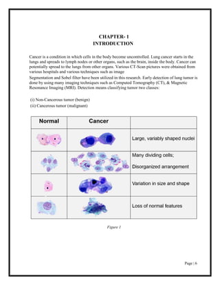 Lung Tumour Detection using Image Processing | PDF