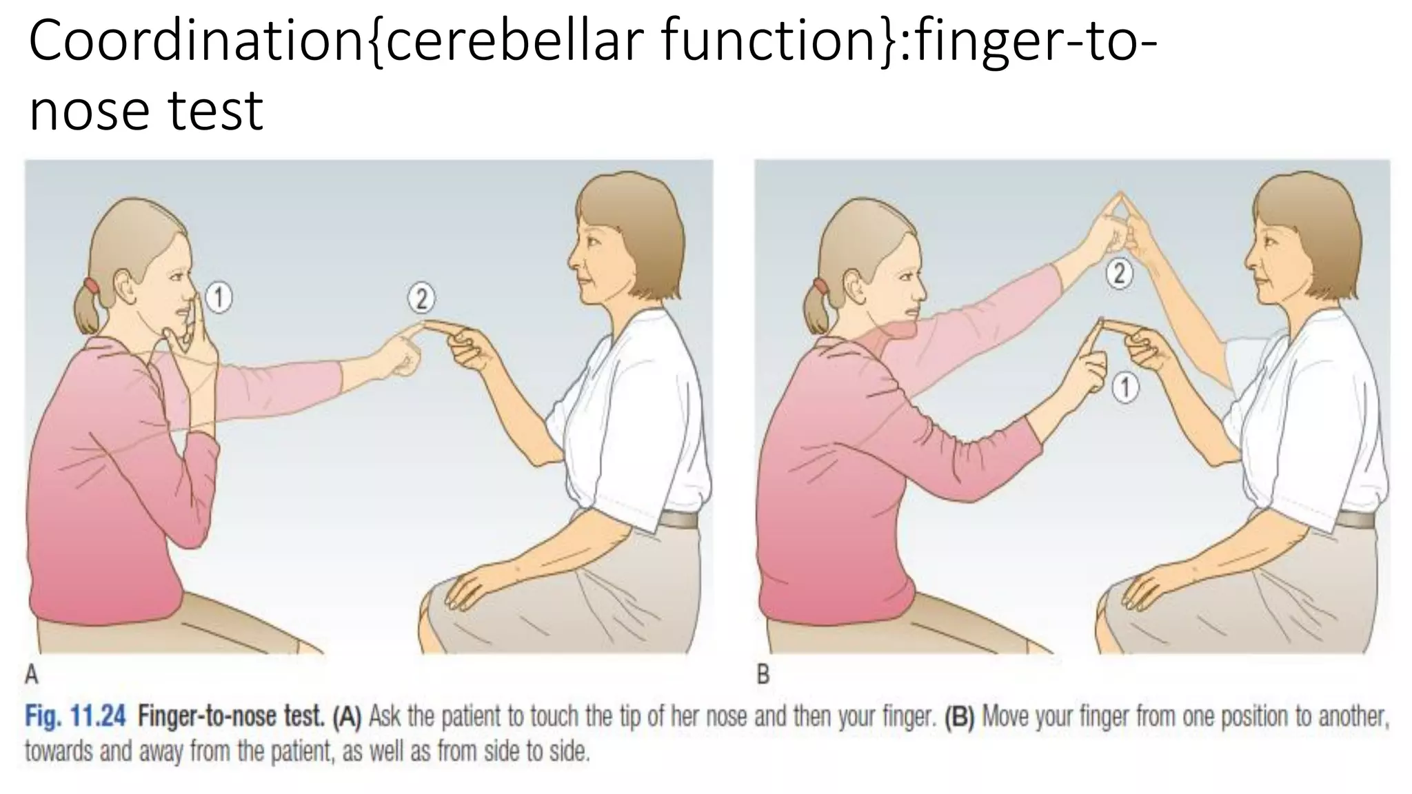 neurological examination by Suleiman Suleiman | PDF