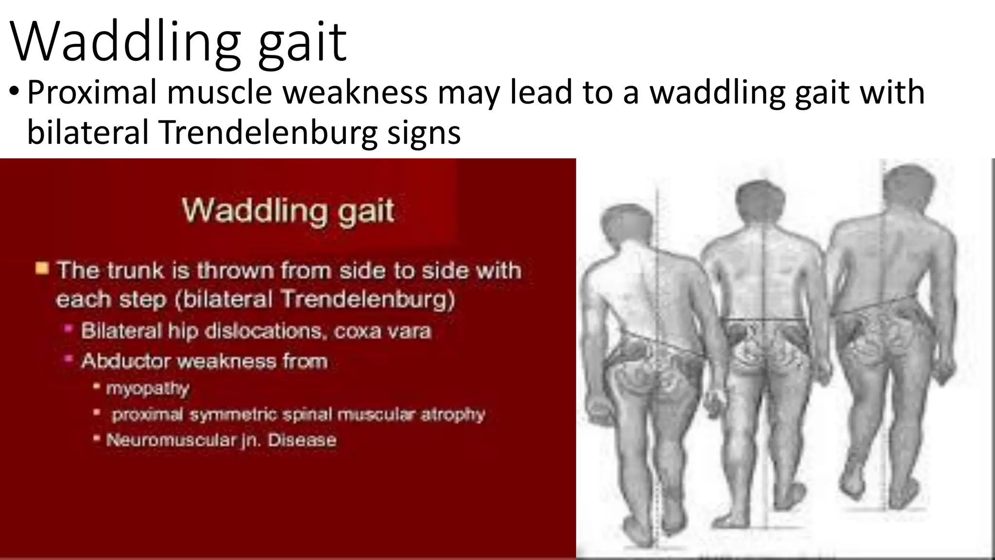 neurological examination by Suleiman Suleiman | PDF