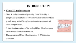mandibular molar distalization SYNOPSIS PPT.pptx