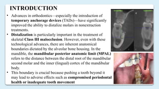 mandibular molar distalization SYNOPSIS PPT.pptx