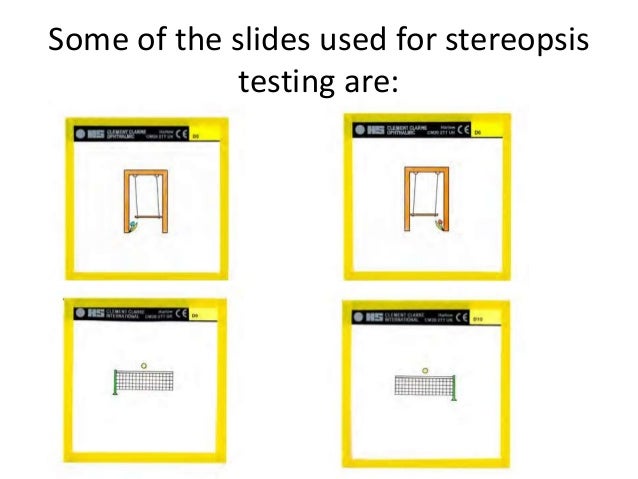 Synoptophore and its parts