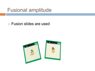 Synoptophore | Major amblyoscope | PPT