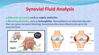 SYNOVIA FLUIDS.pptx | Bone and Joint Conditions | Diseases and Conditions