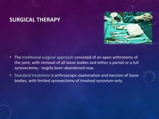 Synovial chondromatosis | PPTX