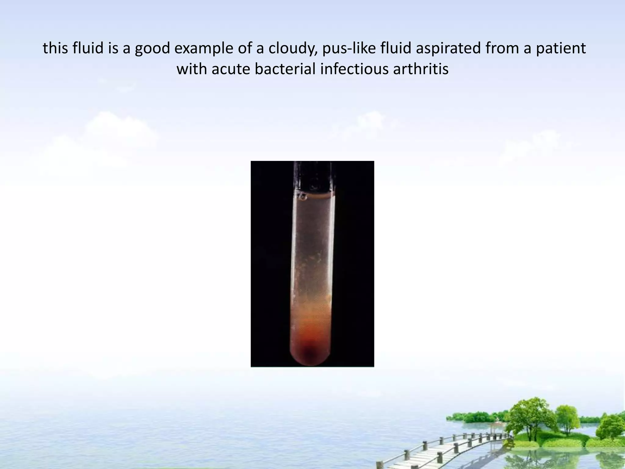 Synovial fluid | PPTX