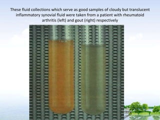 Synovial fluid | PPTX