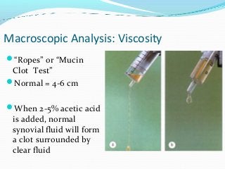 Synovial fluid | PPT
