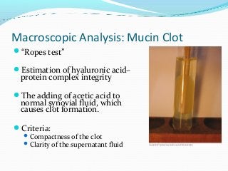 Synovial fluid | PPT