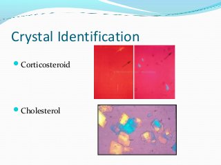 Synovial fluid | PPT