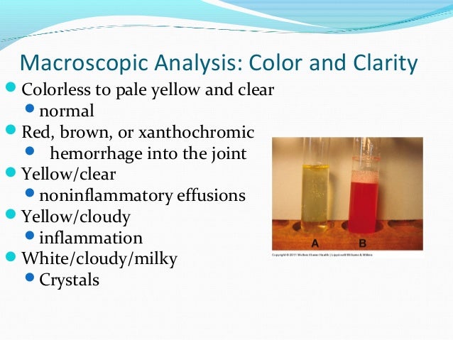 Synovial fluid analysis normal values - hisaomg