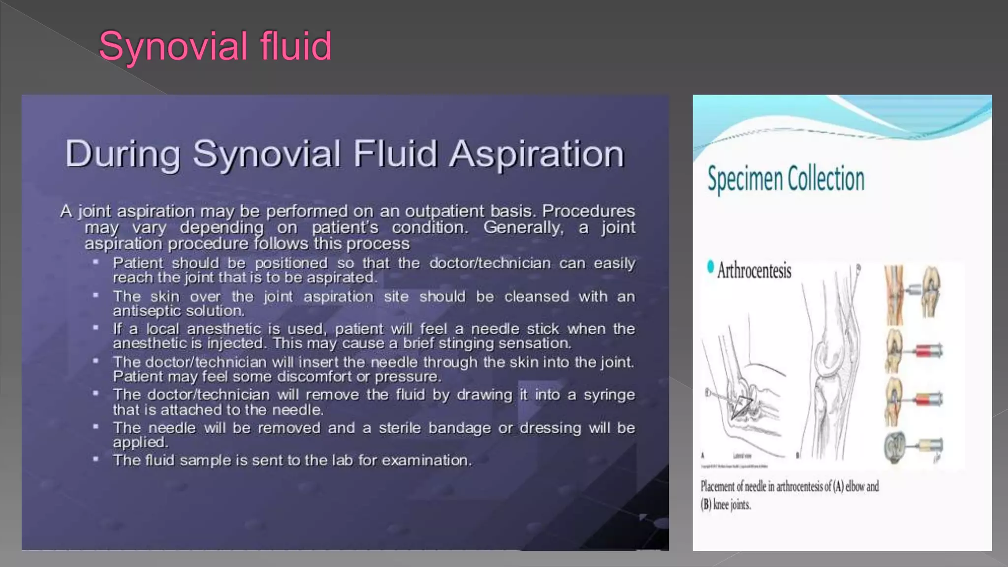 Synovial fluid | PPTX