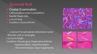 Synovial fluid | PPTX