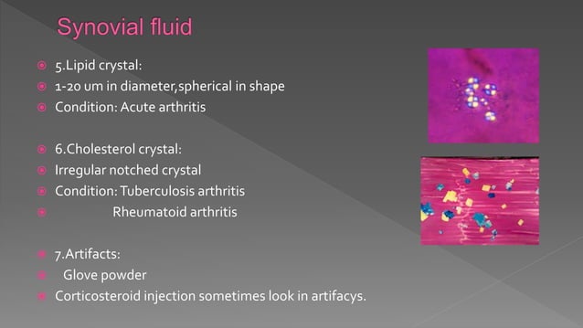 Synovial fluid | PPTX