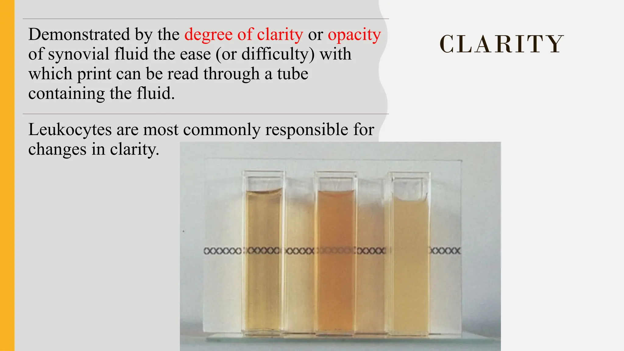 synovial fluid analysis (1) (1).pptx in various disorders | PPTX