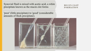synovial fluid analysis (1) (1).pptx in various disorders | PPTX