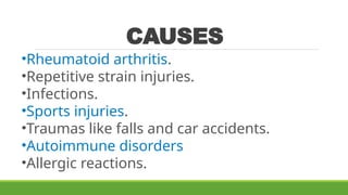 SYNOVITIS.DEFINITION ,CAUSES ,SYMPTOMS AND TREATMENT | PPTX