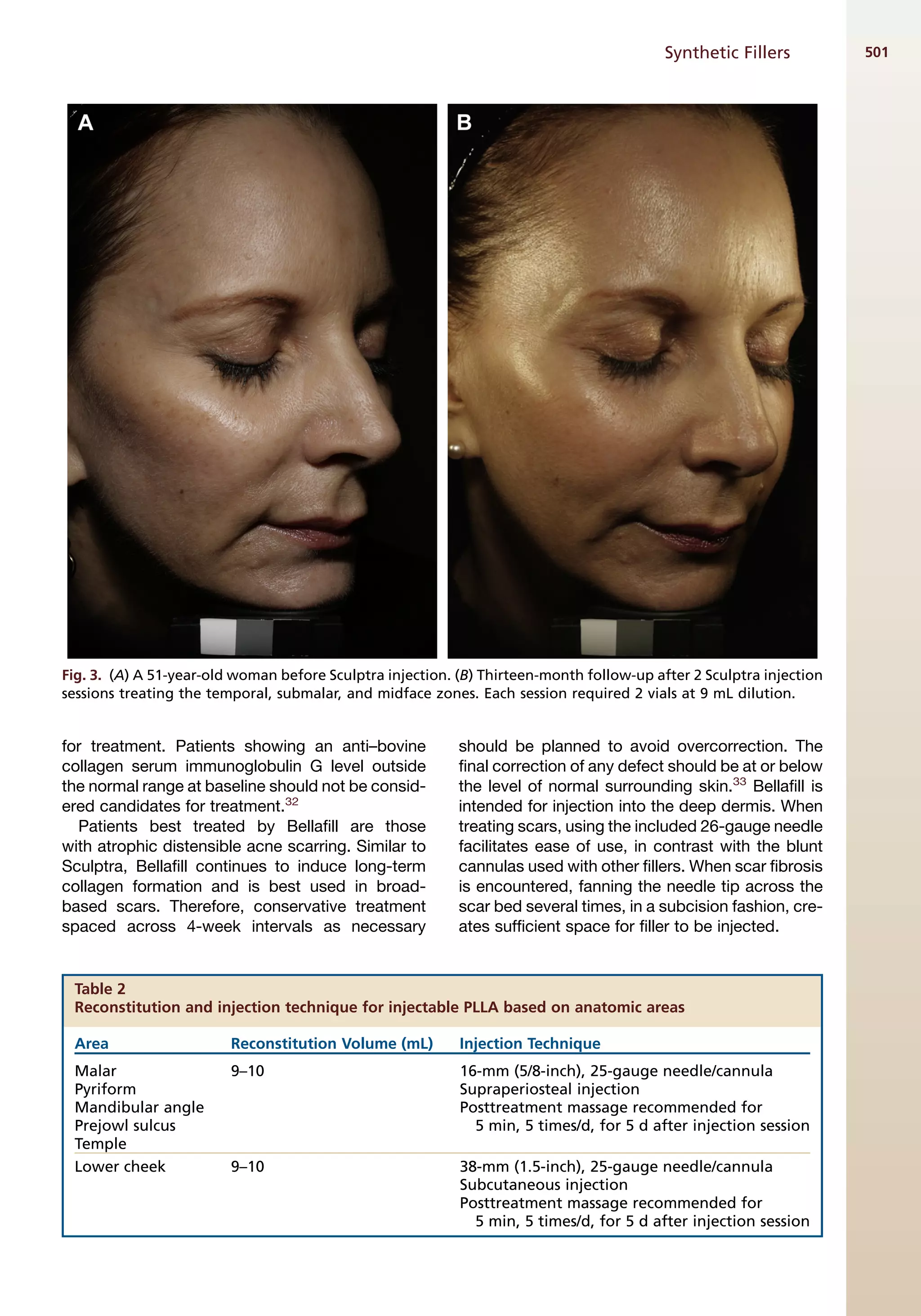 Synthetic fillers for facial rejuvenation | PDF