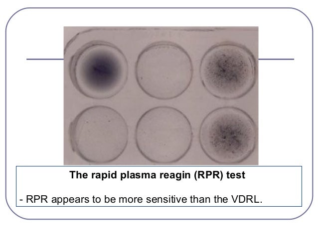Syphalis - final - naglaa