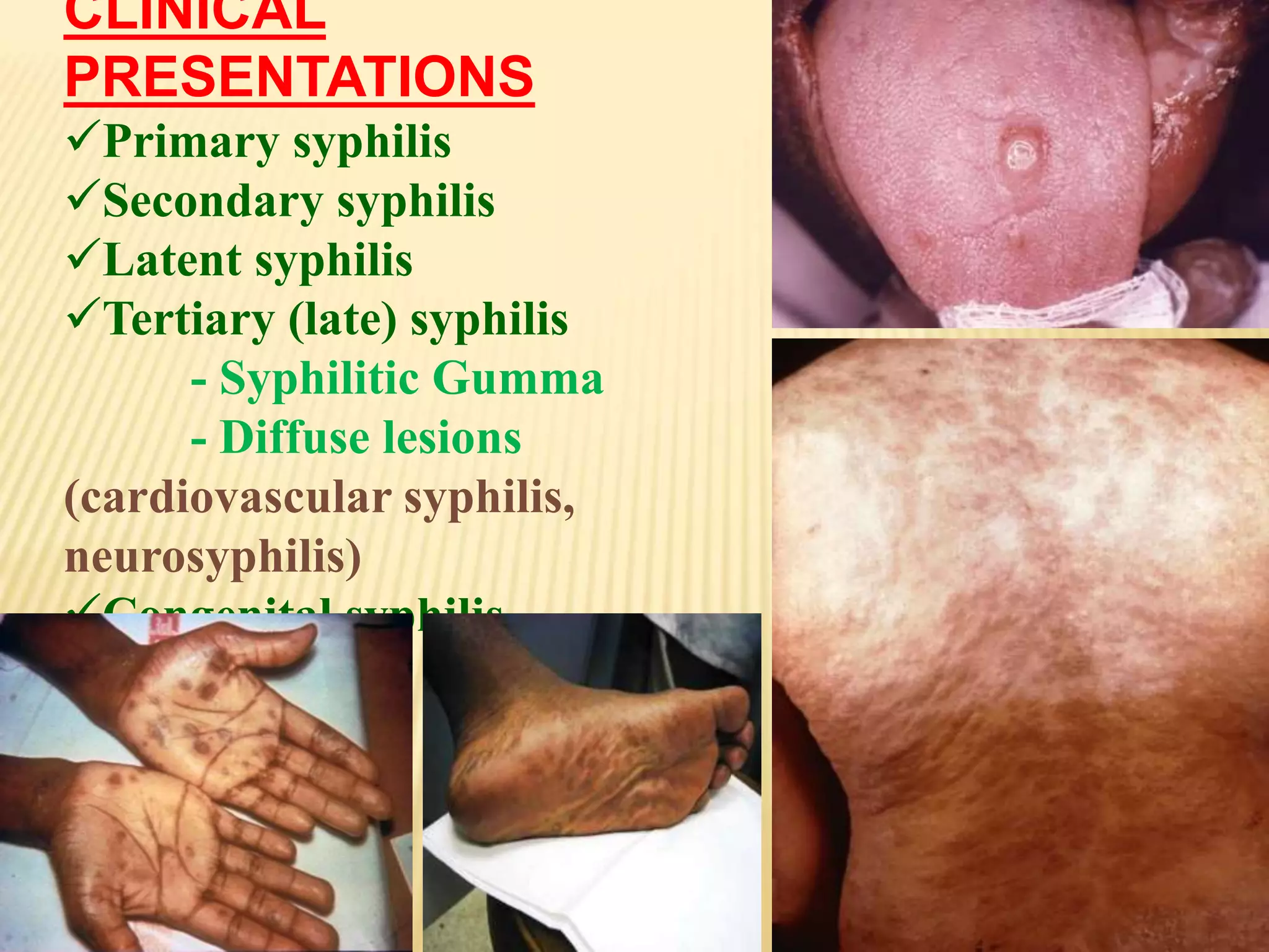 SYPHILIS & GONORRHOEA | PPTX