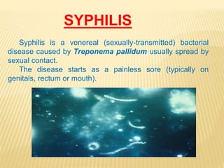 SYPHILIS & GONORRHOEA | PPTX