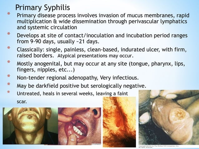 Syphilis | PPT