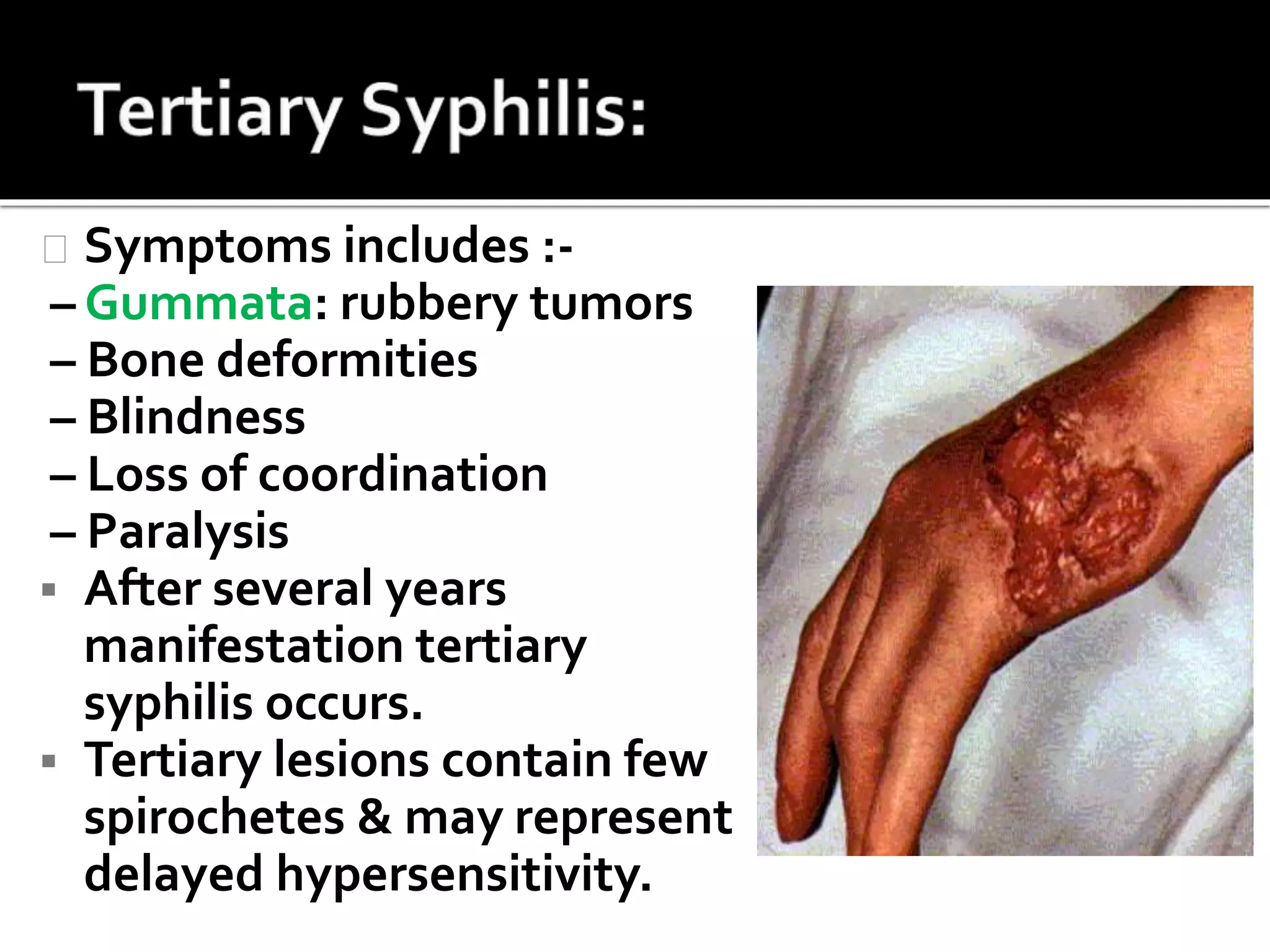 Syphilis | PPTX