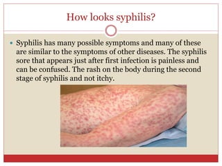 Syphilis | PPTX