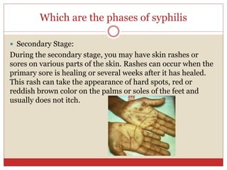 Syphilis | PPTX