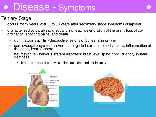 Syphilis PPT