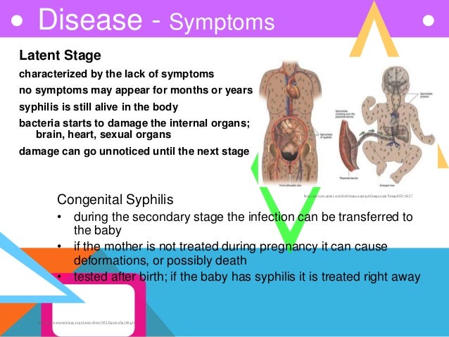 Syphilis PPT