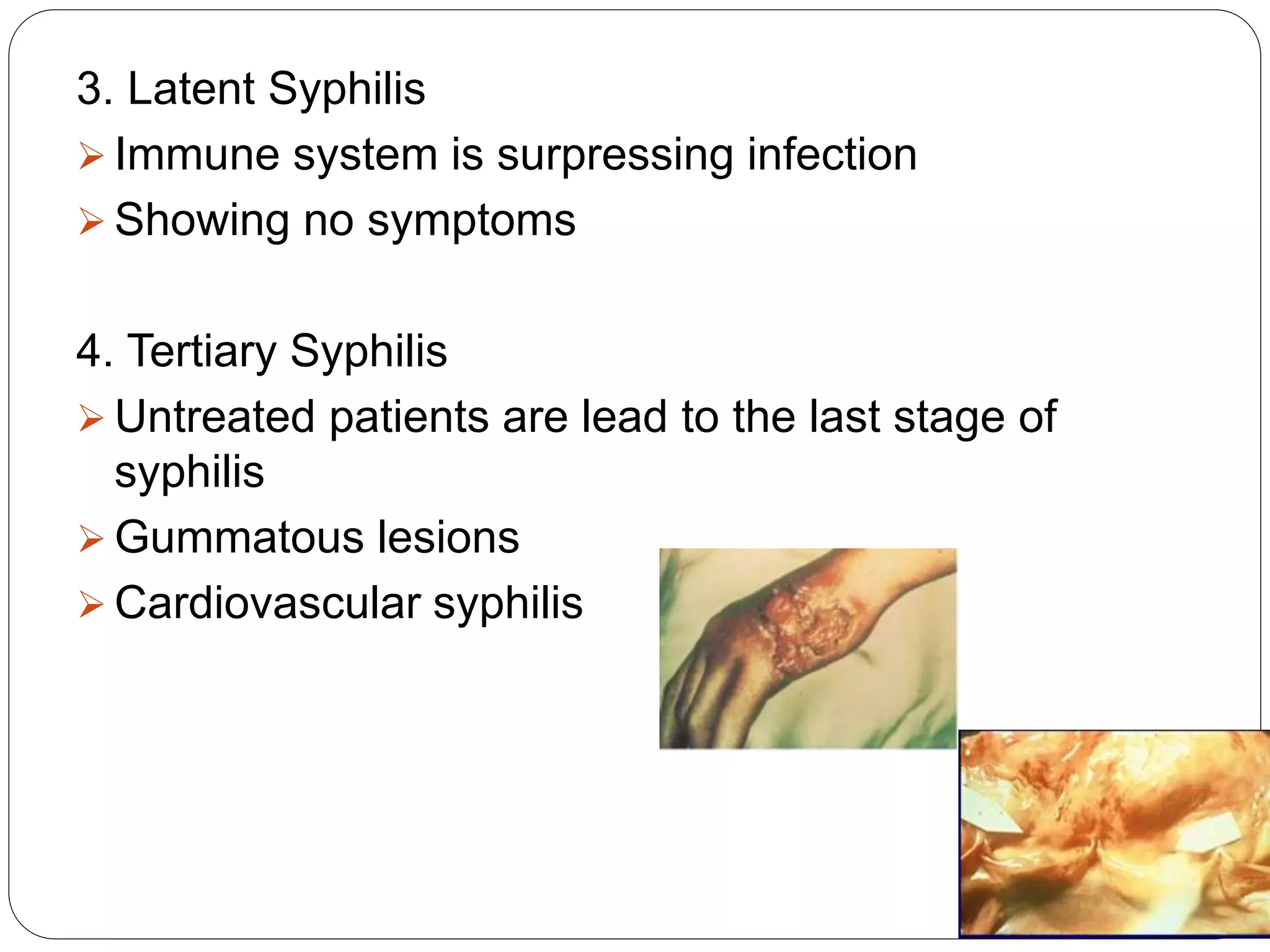 Syphilis | PPTX