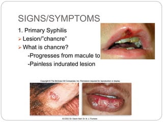 Syphilis | PPTX