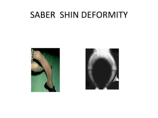 Sabre Shin