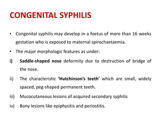 Syphilis | PPSX