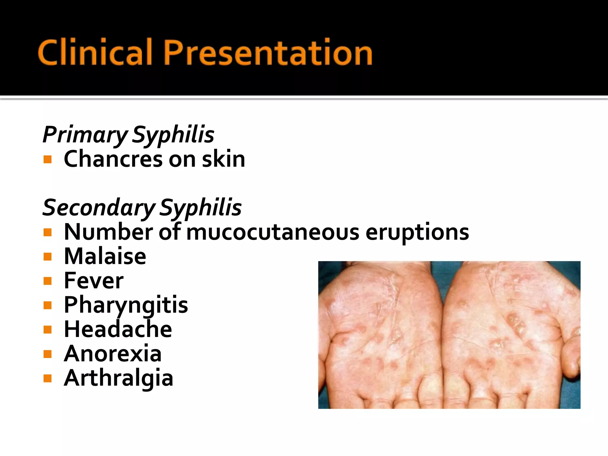 Syphilis | PPTX