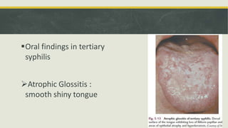syphilis.pptx