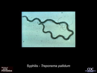 syphilis.ppt