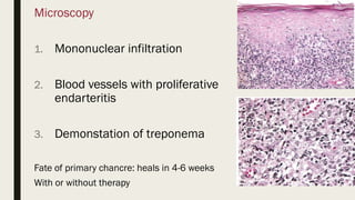 Brief Information about the Disease Syphilis | PPTX