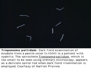 Treponema Pallidum Dark Field