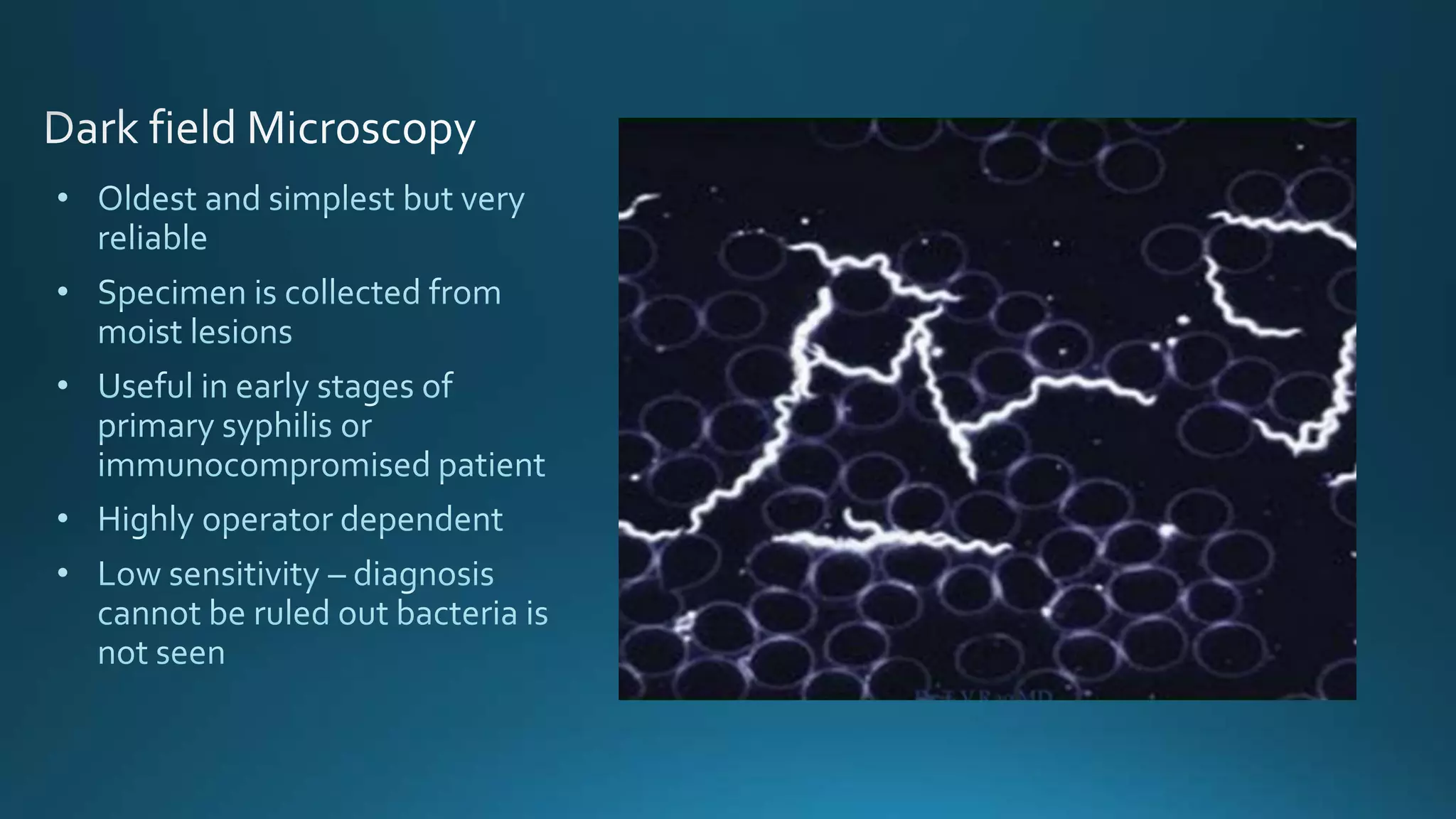 Syphilis and VDRL Test.pptx