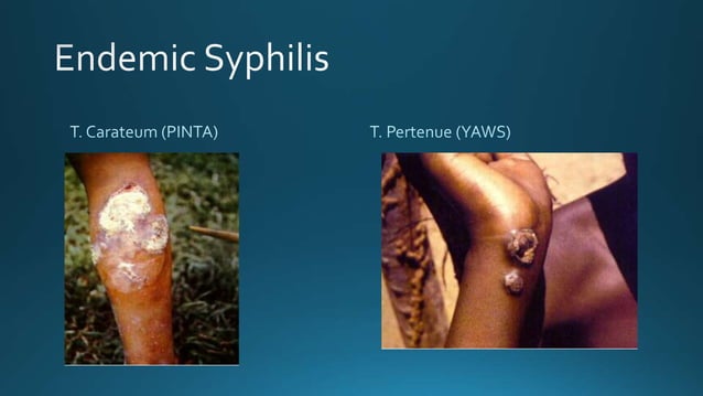 Syphilis and VDRL Test.pptx