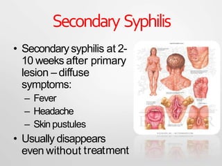 Syphilis by swami | PPT