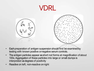 Syphilis by swami | PPT