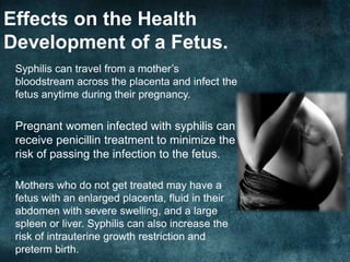 Syphilis | PPTX