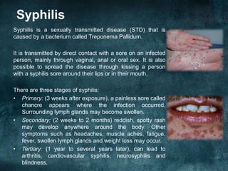 Syphilis | PPT
