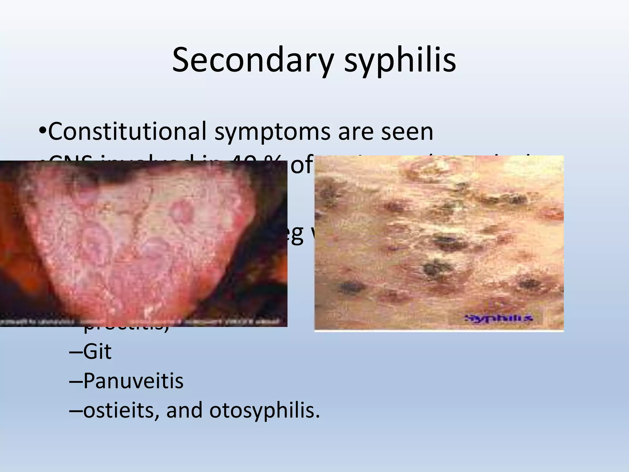 Syphilis new.pptx [repaired] | PPT